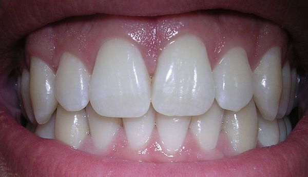 Tooth and Teeth Research Review - Neatorama